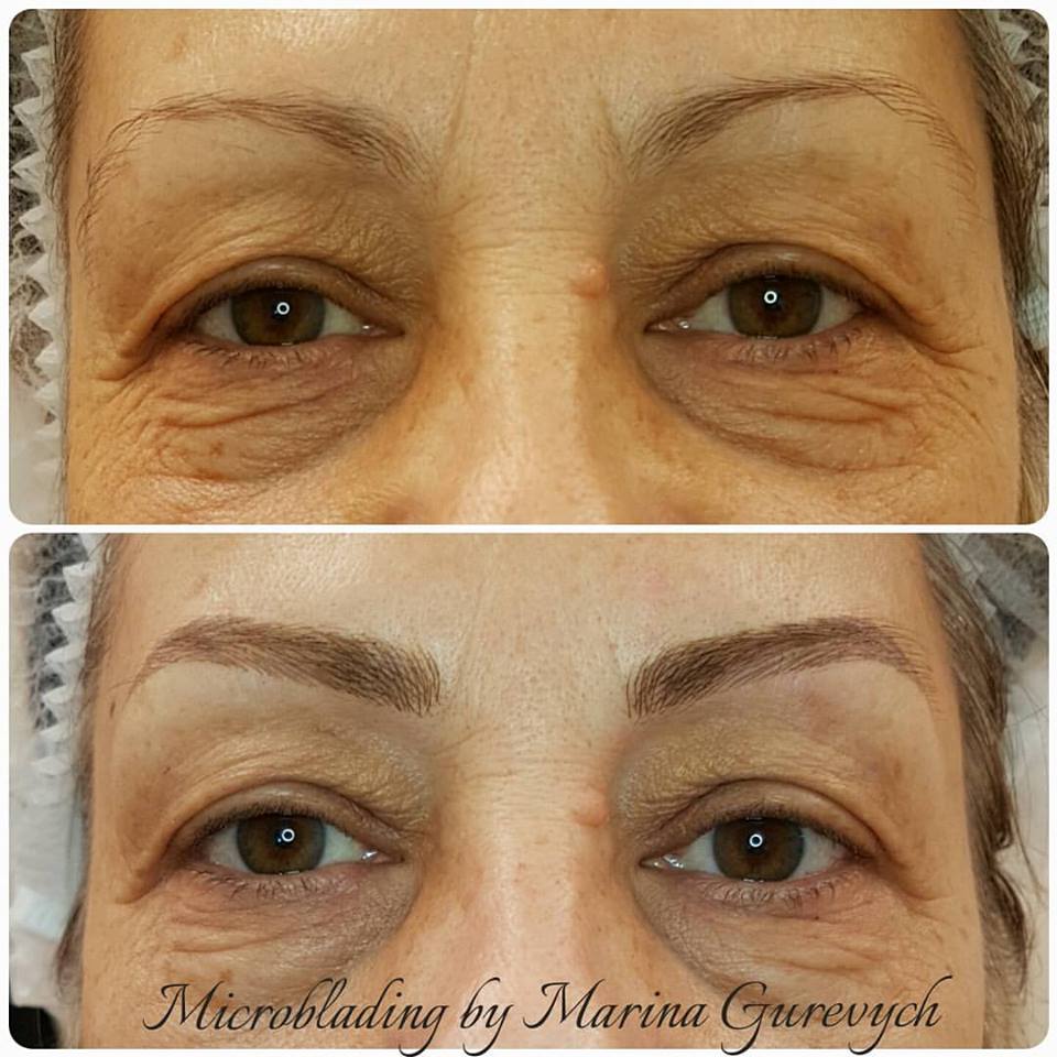 Microblading - BeauLine Aesthetics