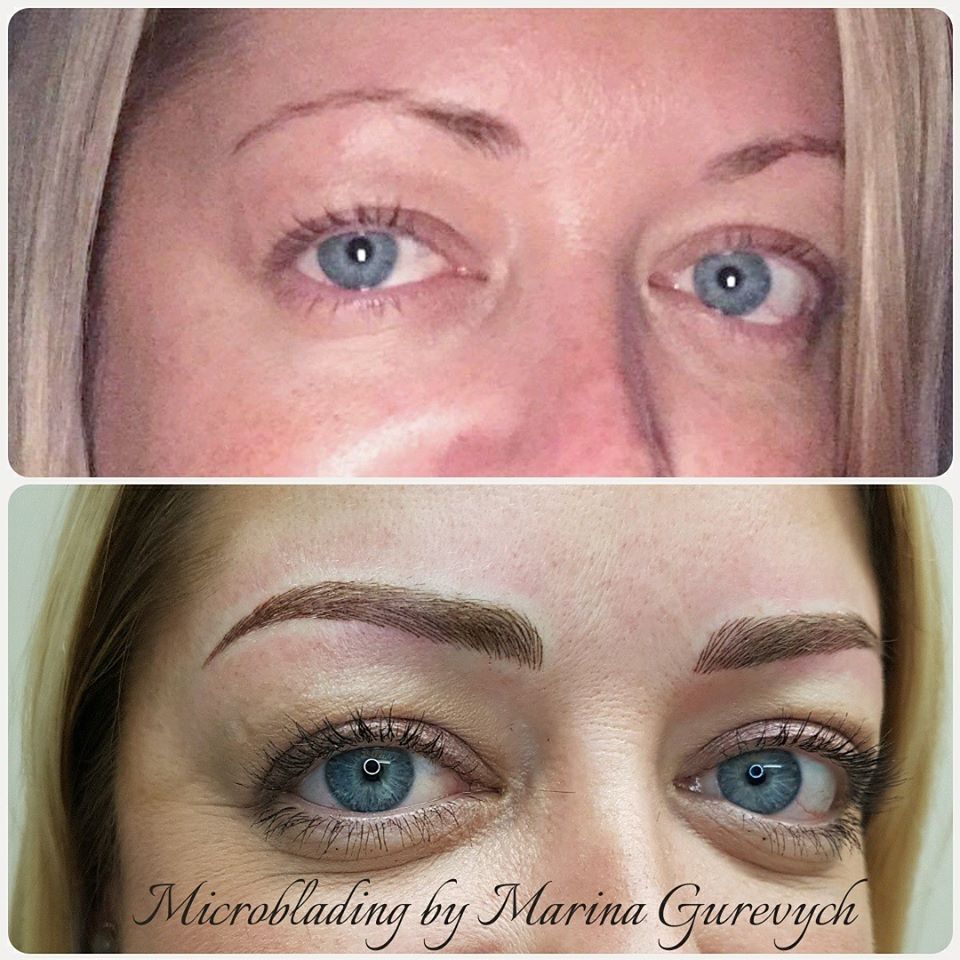 microblading - BeauLine Aesthetics